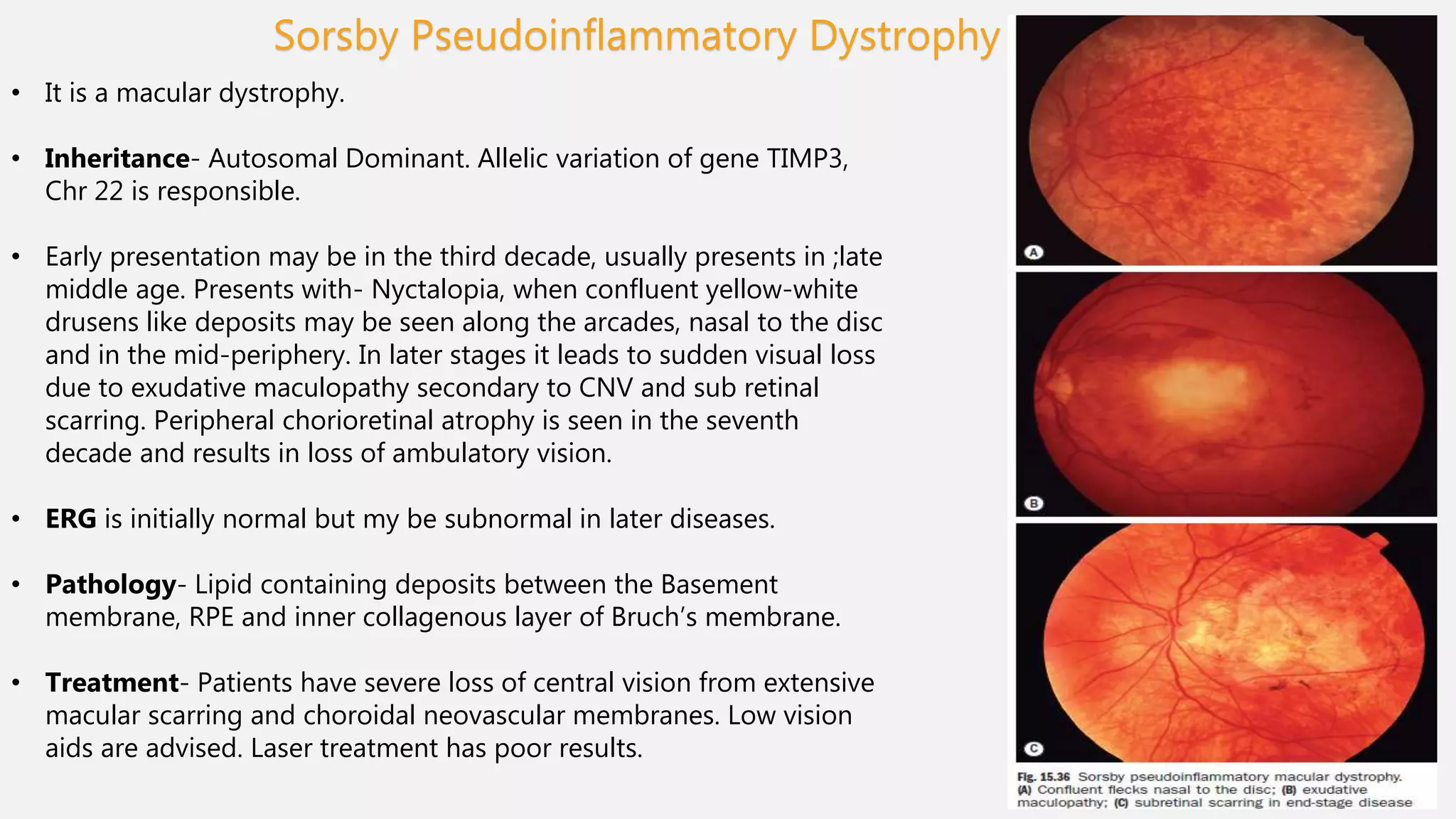 Retinal dystrophy | PPTX
