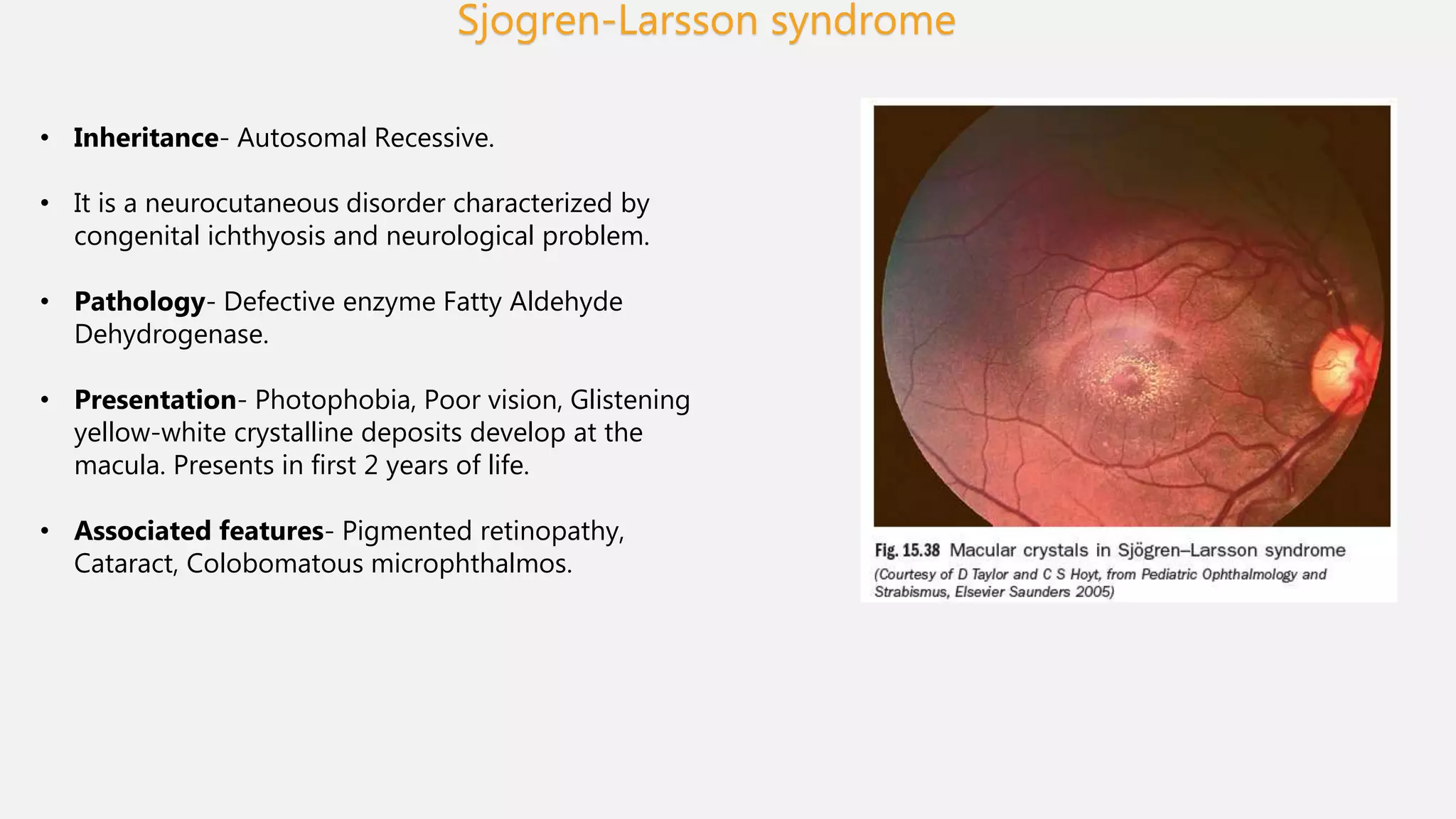 Retinal dystrophy | PPTX