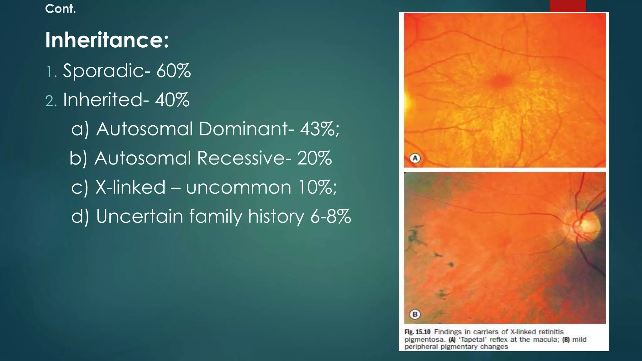 Retinal Dystrophy. Farhad - Copy.pptx | Eye and Vision Conditions ...