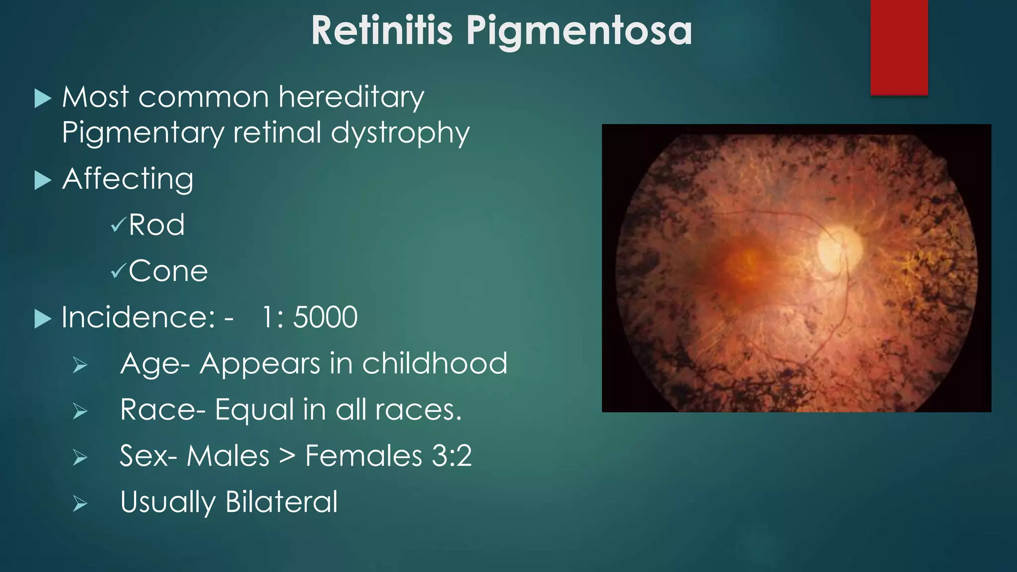 Retinal Dystrophy. Farhad - Copy.pptx | Eye and Vision Conditions ...
