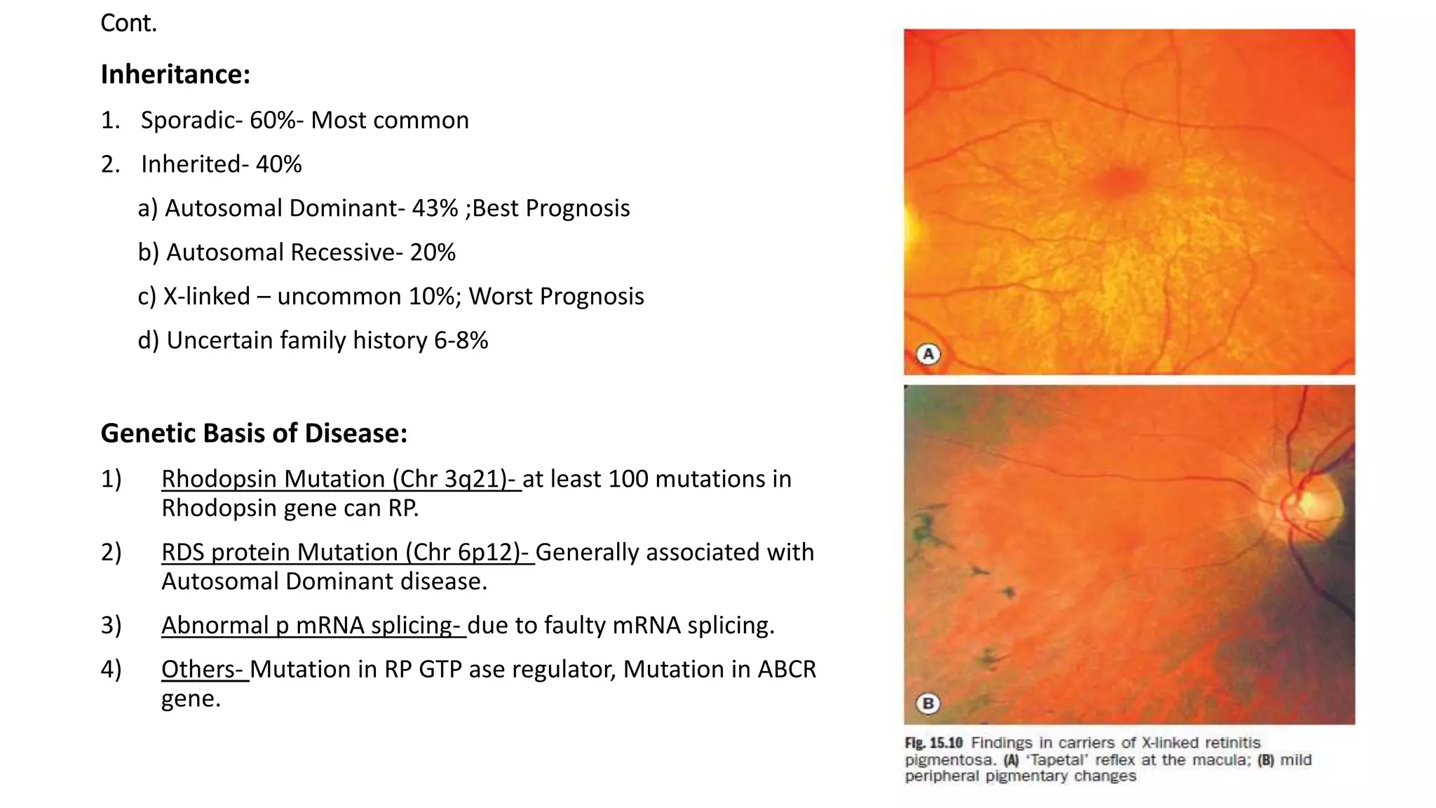 Retinal Dystrophy 1. Farhad.pptx | Eye and Vision Conditions | Diseases ...