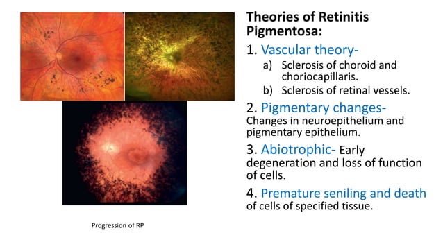 Retinal Dystrophy 1. Farhad.pptx | Eye and Vision Conditions | Diseases ...