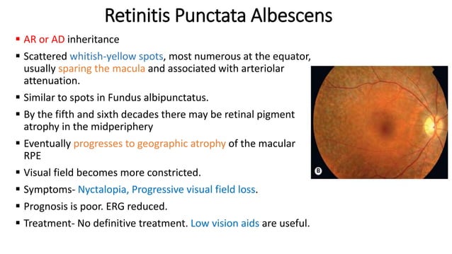 Retinal Dystrophy 1. Farhad.pptx | Eye and Vision Conditions | Diseases ...