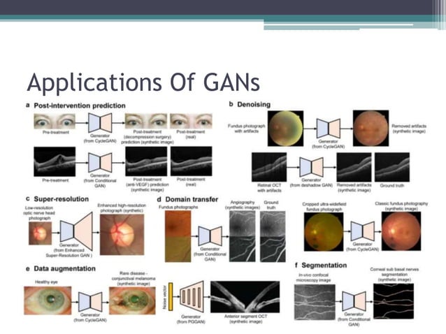Retinal Image Analysis using Machine Learning and Deep.pptx | Eye and Vision Conditions ...