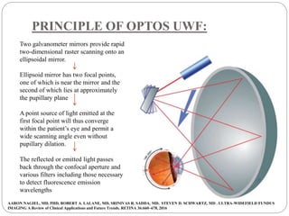 Retinal imaging | PPTX