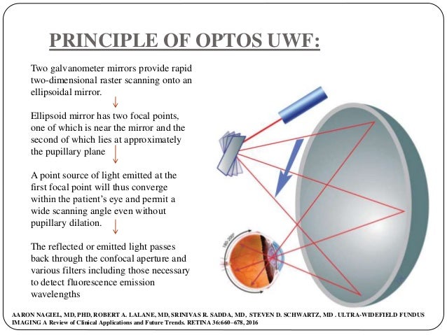 Retinal imaging