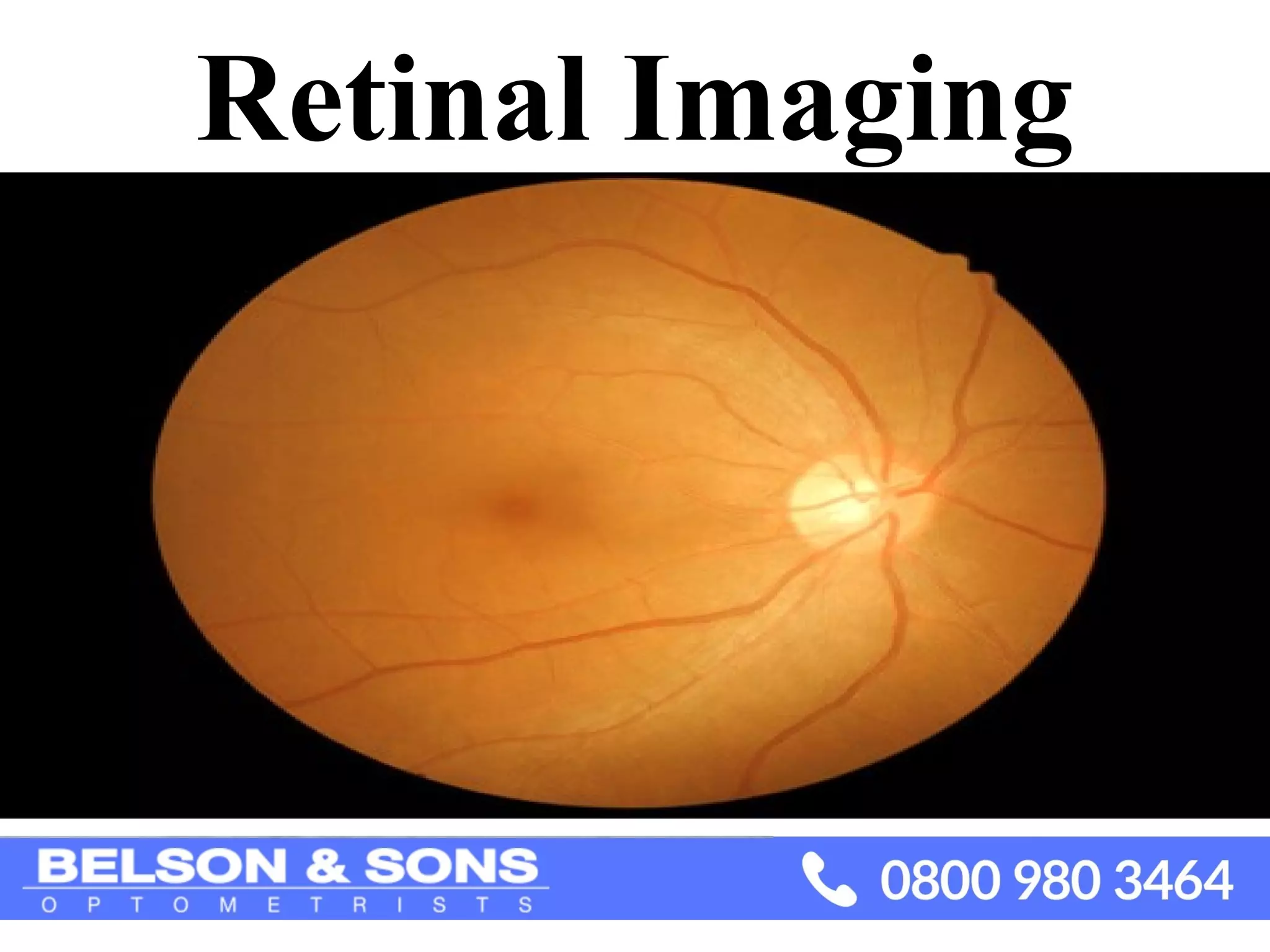 Retinal imaging | PPT