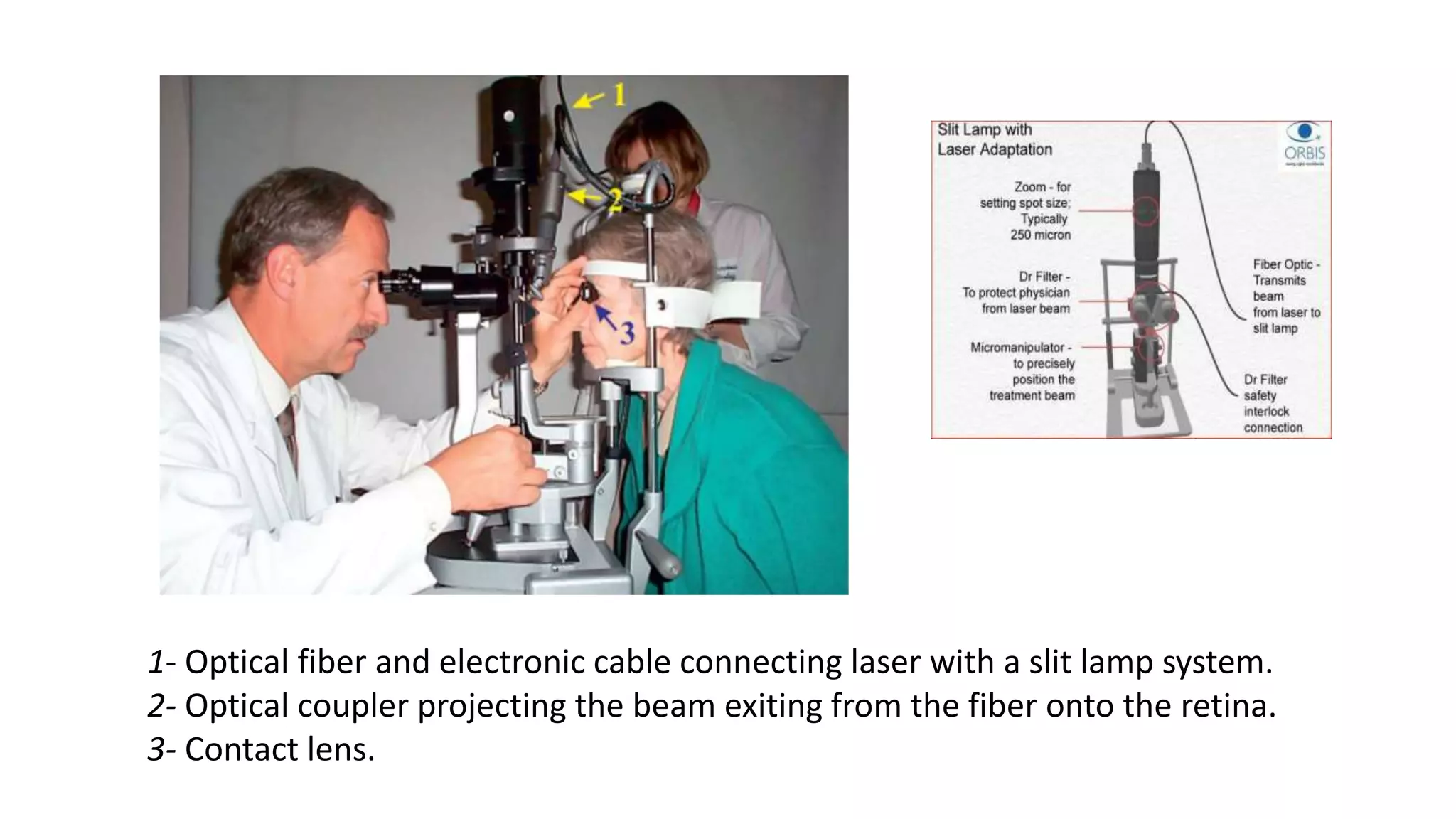 Retinal laser therapy | PPTX