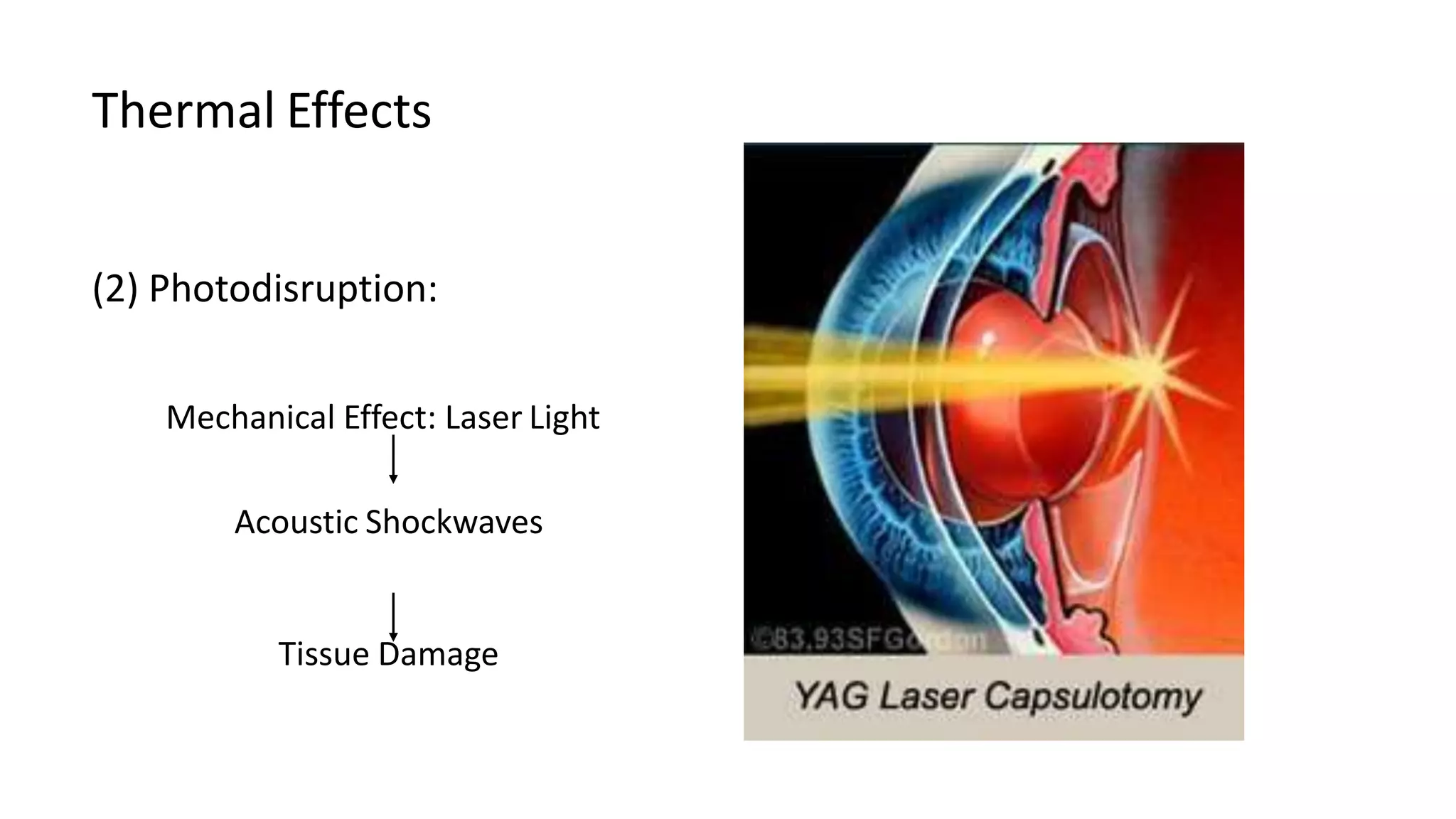 Retinal laser therapy | PPTX