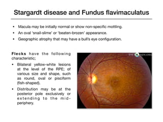 Retinal pigmented fundus | PDF