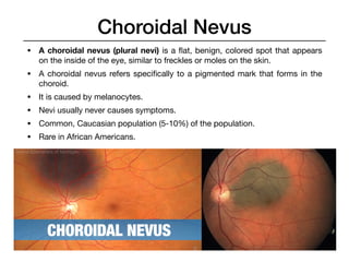 Retinal pigmented fundus | PDF