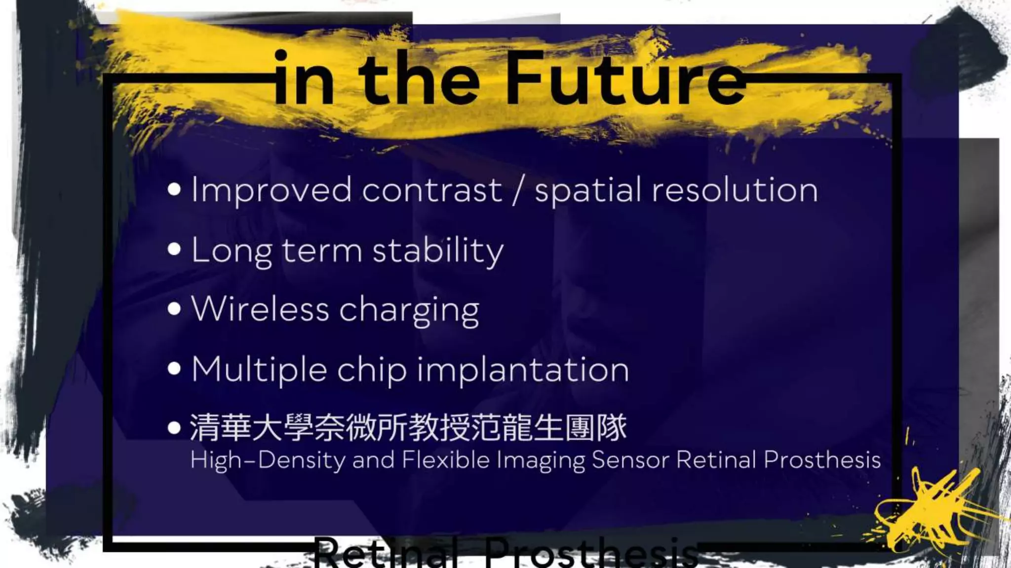 Retinal prosthesis | PPTX