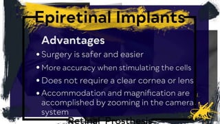 Retinal prosthesis | PPT