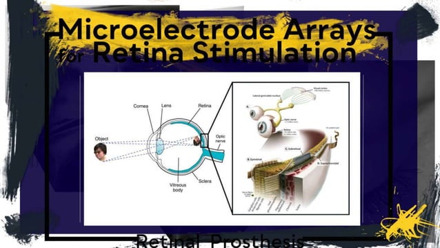 Retinal prosthesis | PPT
