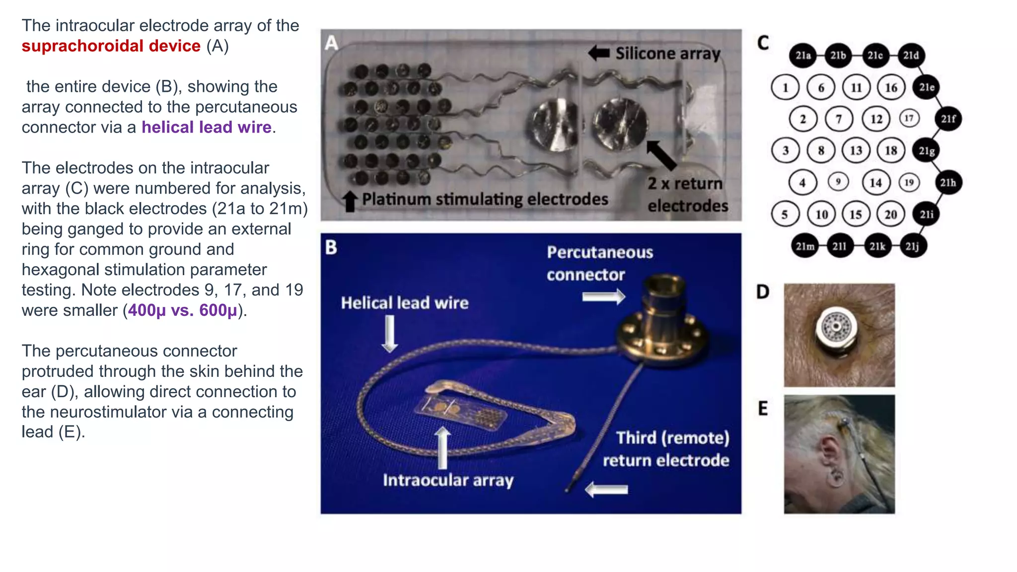 Retinal prosthesis | PPTX
