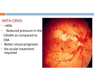 retinal vascular occlusions crvo brvoppt | PPTX