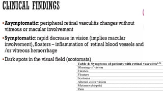retinal vasculitis final clinical presentation | PPTX