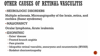 retinal vasculitis final clinical presentation | PPTX
