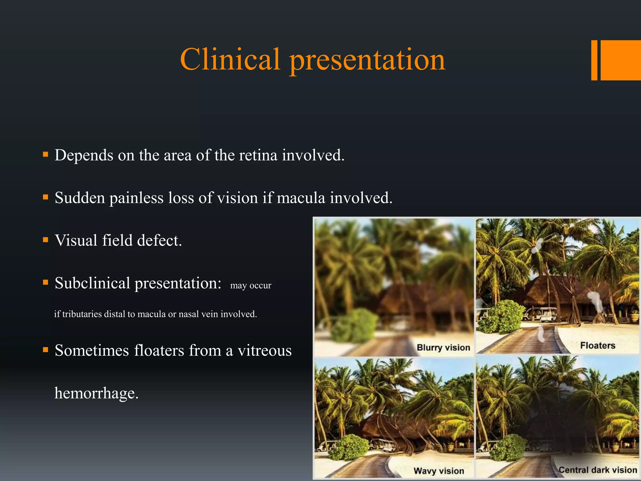Retinal vein occlusion | PPTX