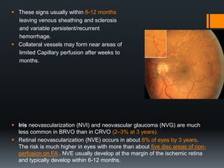 Retinal vein occlusion | PPTX