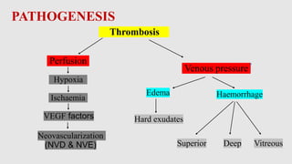 RETINAL VEIN OCCLUSION; CRVO & BRVO types, pathophysiology, diagnosis ...