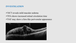 RETINAL VEIN OCCLUSION; CRVO & BRVO types, pathophysiology, diagnosis ...