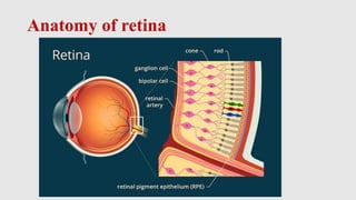RETINAL VEIN OCCLUSION; CRVO & BRVO types, pathophysiology, diagnosis ...