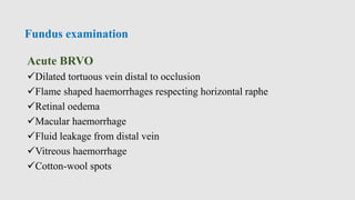 RETINAL VEIN OCCLUSION; CRVO & BRVO types, pathophysiology, diagnosis ...