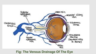 RETINAL VEIN OCCLUSION; CRVO & BRVO types, pathophysiology, diagnosis ...