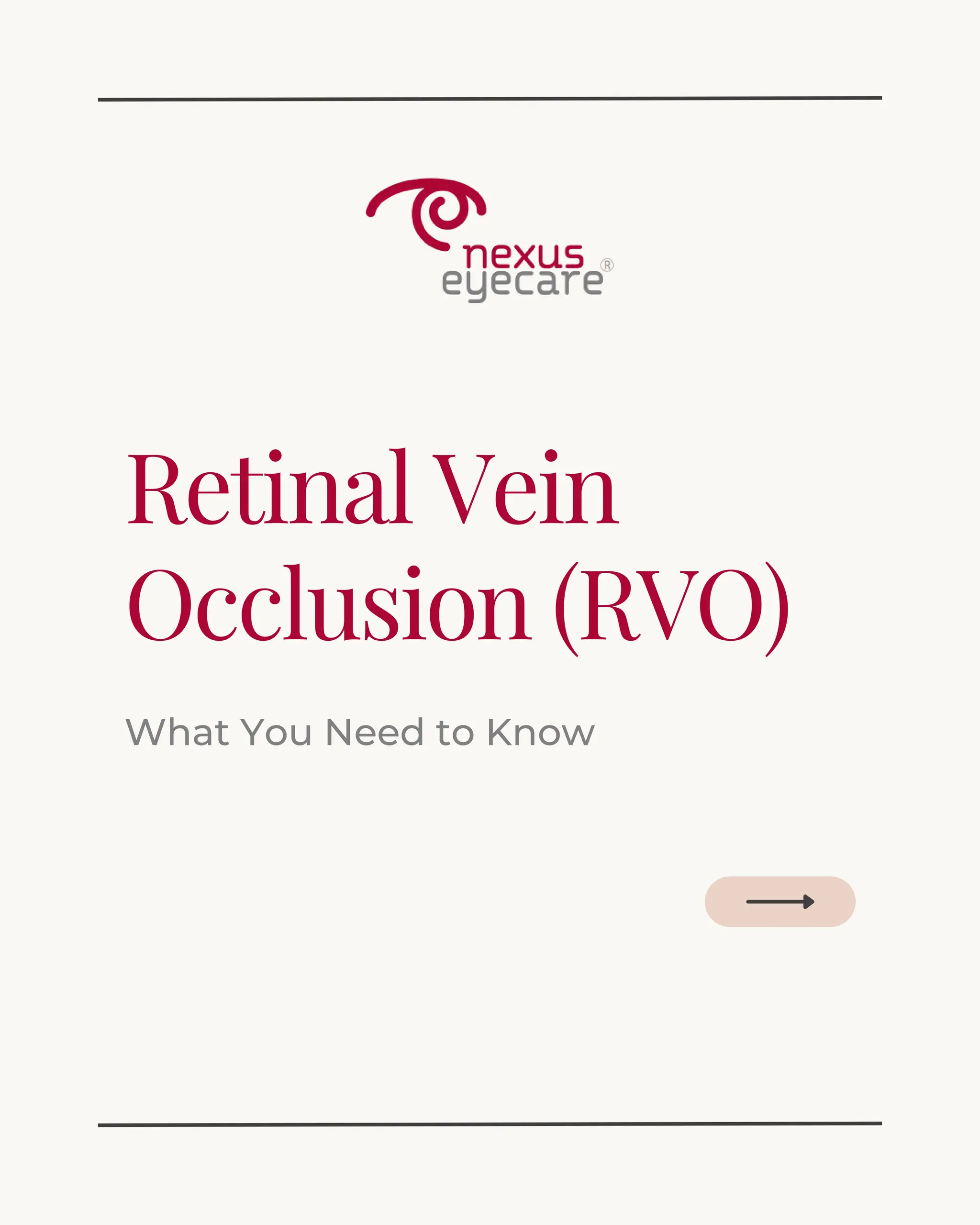 Retinal Vein Occlusion (RVO) – What You Need to Know! | PDF
