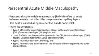 Retinal vein occlusions | PPTX