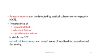 Retinal vein occlusions | PPTX