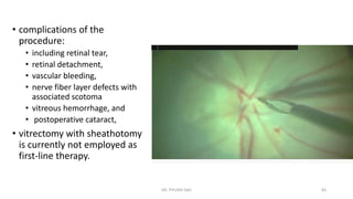 Retinal vein occlusions | PPTX