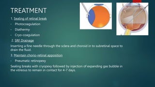 RETINA-retinal detatchment powerpoint presentation | PPTX | Eye and ...