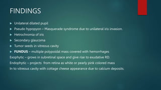 RETINA-retinal detatchment powerpoint presentation | PPTX