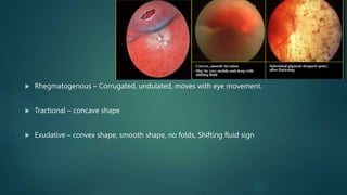 RETINA-retinal detatchment powerpoint presentation | PPTX | Eye and ...