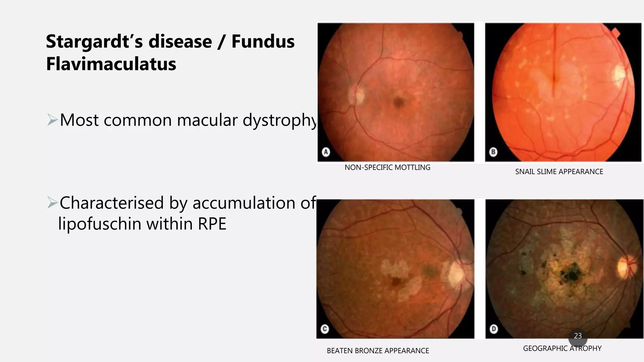 Physiology of Retina | PPTX