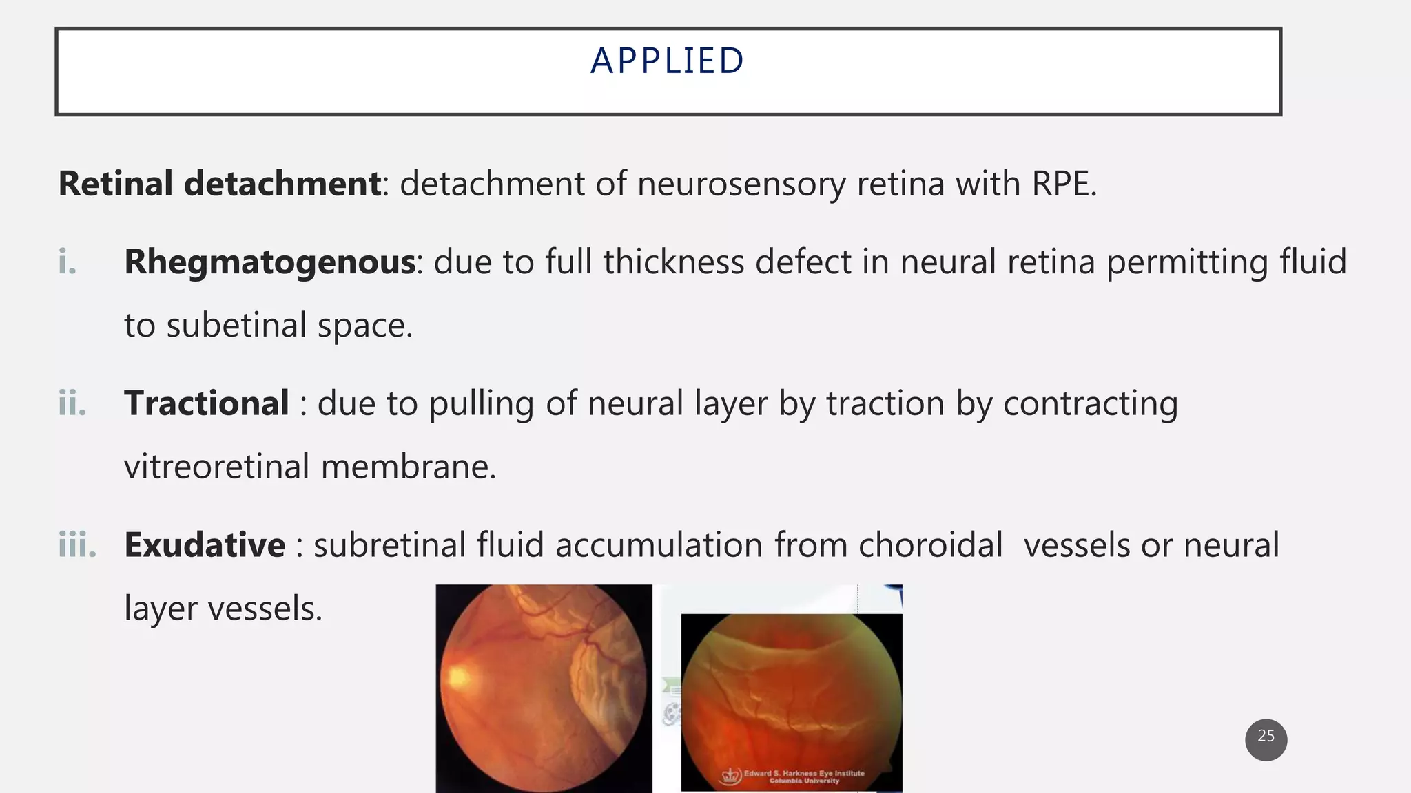 Physiology of Retina | PPTX