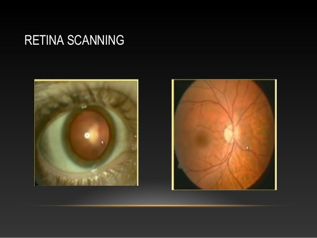 Retina recognition biometrics drishtysharma