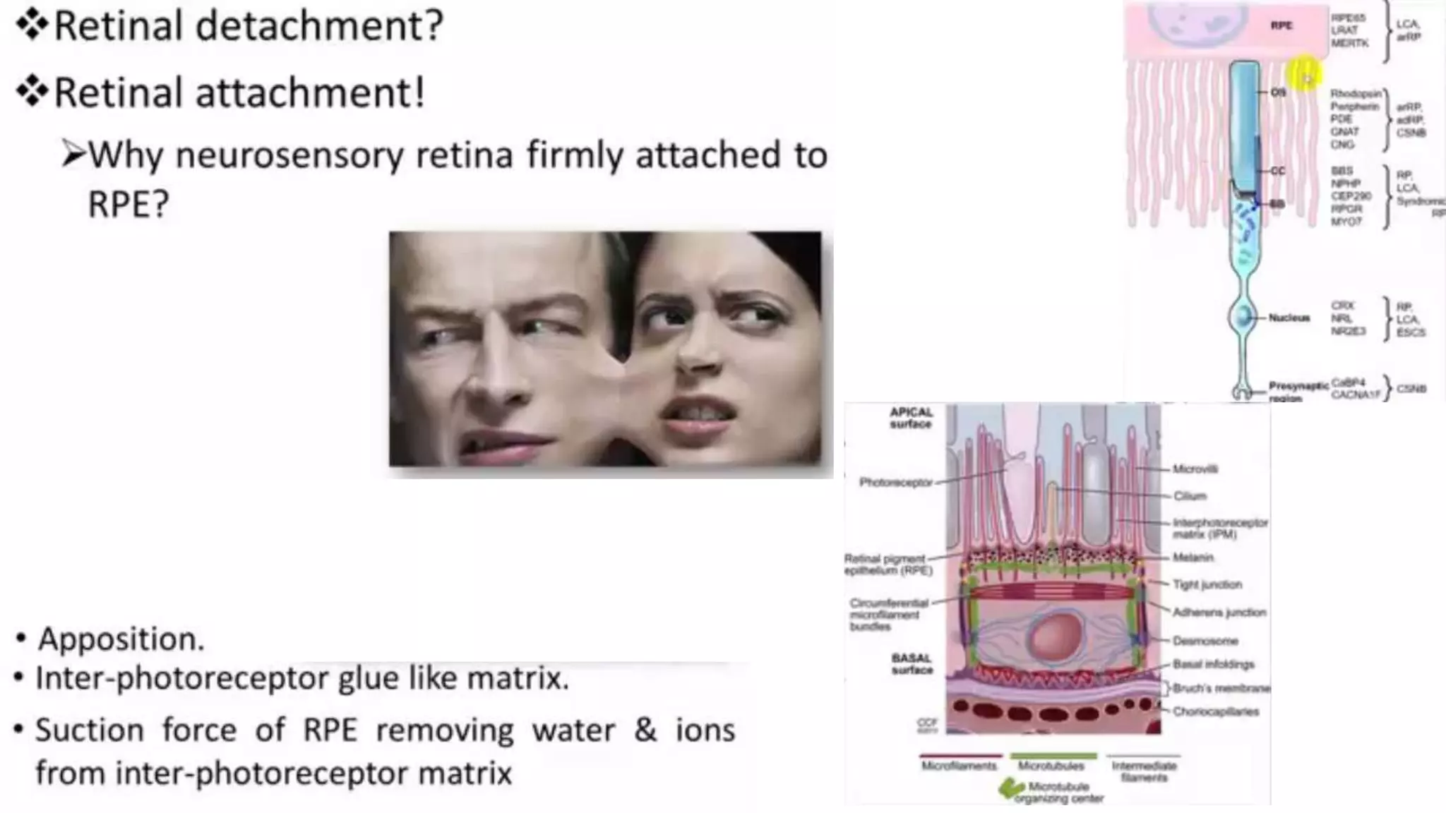 Retina retinal detachment | PPTX