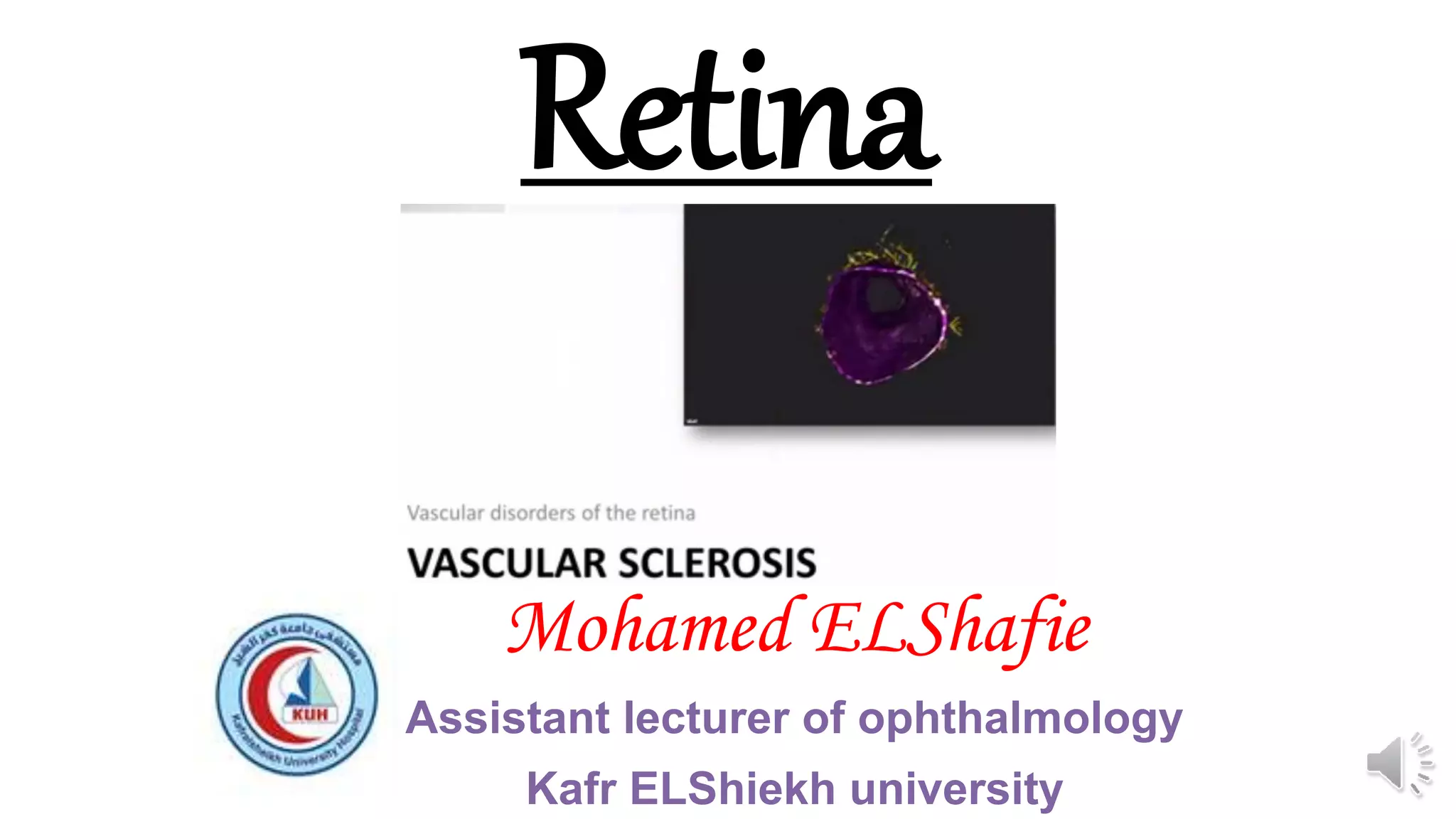 Retina vascular sclerosis | PPTX