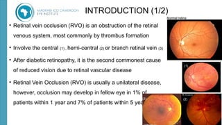 Retina veine occlusion magrabi ico cameroun .potx