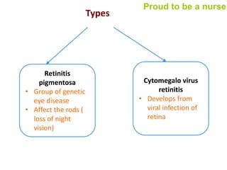 RETINITIS.pptx