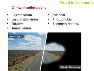 RETINITIS.pptx