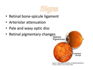 Retinitis pigmentosa | PPTX