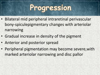 Retinitis pigmentosa | PPTX