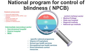 retinitis blindness slide about inflammation of retina | PPT | Free ...