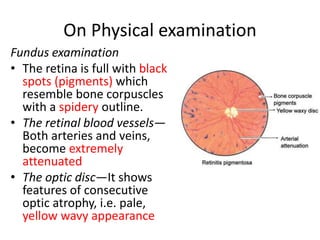 Retinitis pigmentosa (opthalmology) | PPTX | Eye and Vision Conditions ...