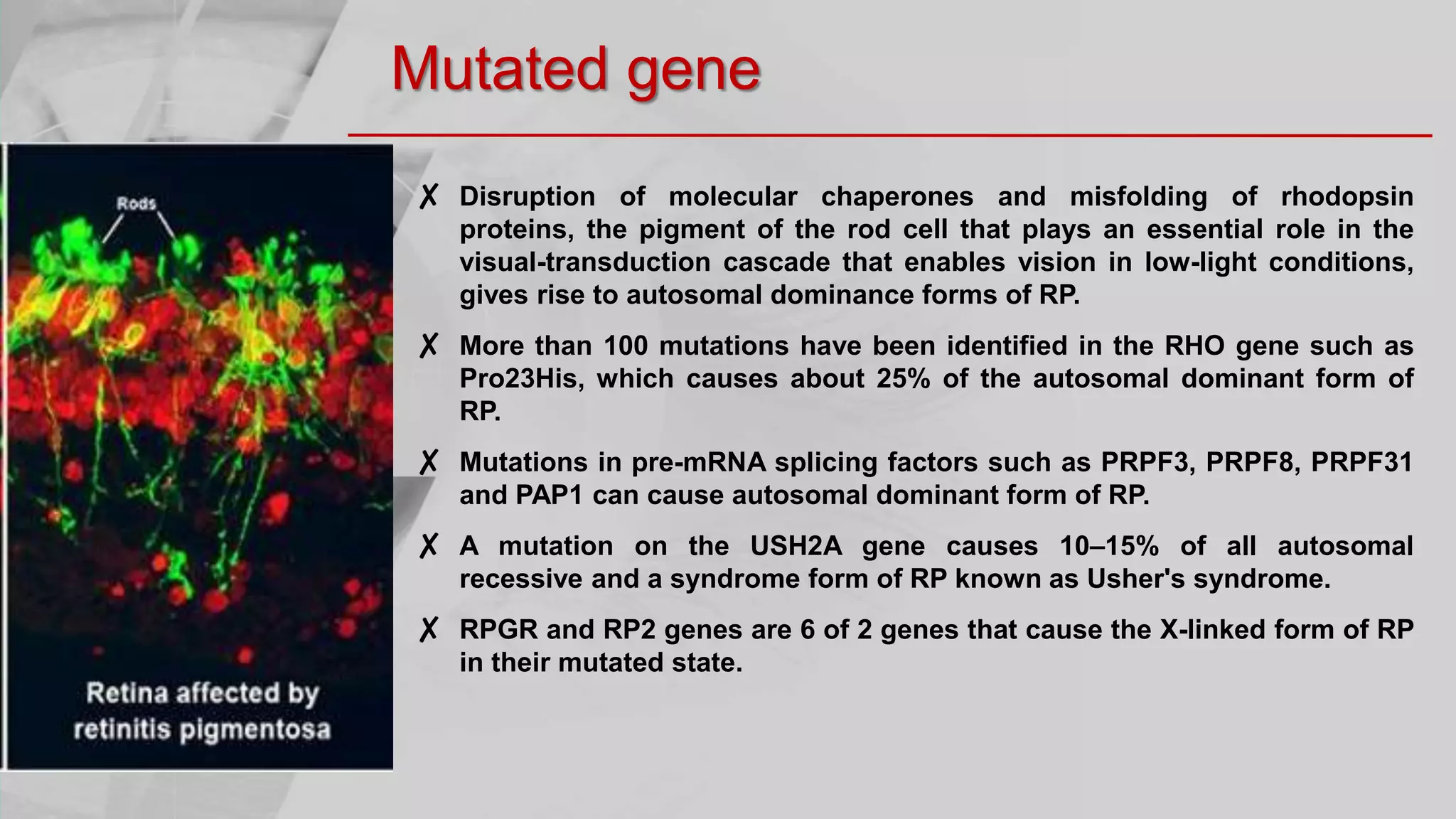 Retinitis pigmentosa | PPTX