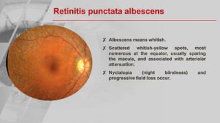 Retinitis pigmentosa | PPTX